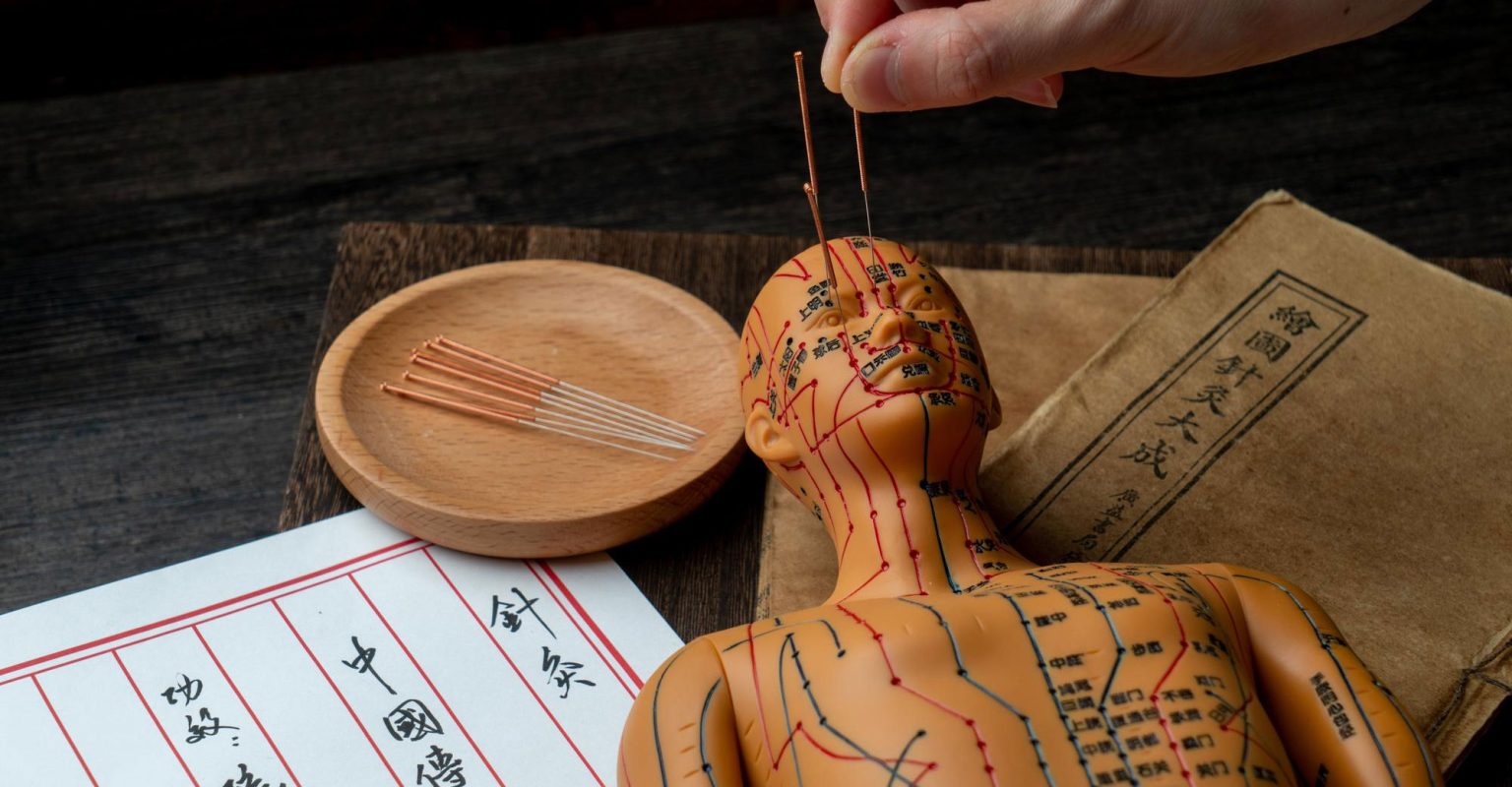 Acupuncture - Scott Gralla Acupuncture - Greenlawn, NY
